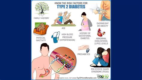 Epidemiology Of Diabetic Retinopathy Ppt