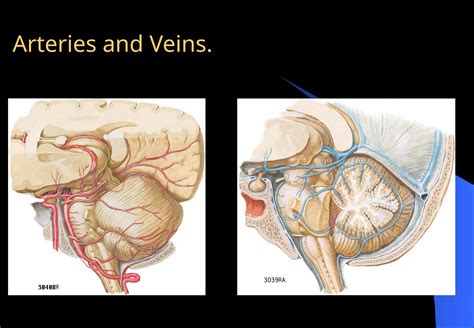 Posterior Fossa Tumors Anesthesia Management And Special Problem Pptx