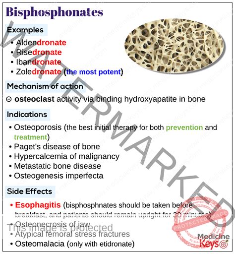 Orthodontics And Bisphosphonates At Dennis Fleming Blog