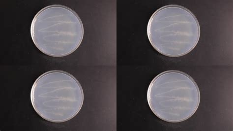 放线菌pda培养基培养皿 视频素材下载 编号 9770984 光厂 Vj师网