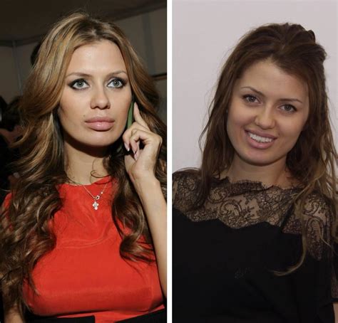 Виктория боня до пластики и после фото Виктория Боня шокировала