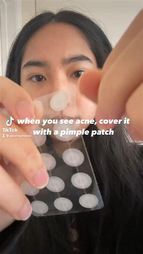 Just Use A Pimple Patch Skin Care Acne Pimples