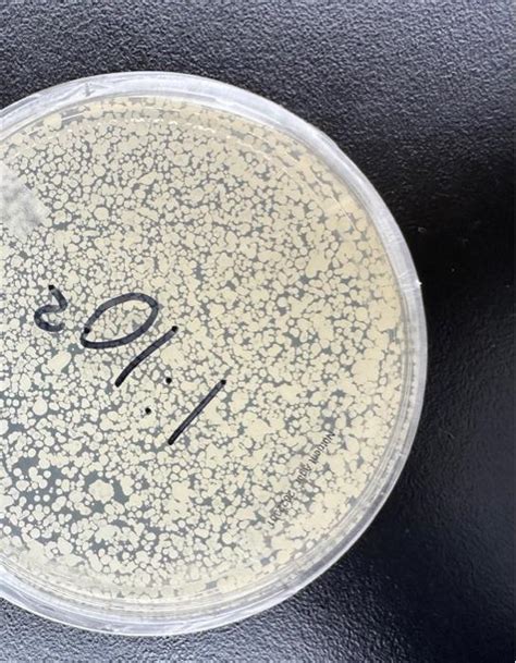 Solved EXERCISE ISOLATION OF BACTERIA BY DILUTION Chegg