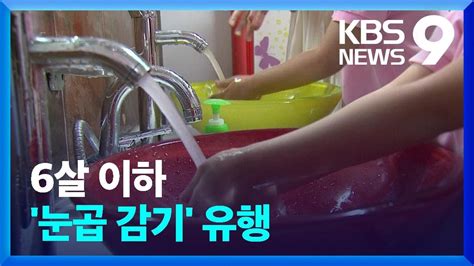 아데노바이러스 감염 유행 개인 위생 철저히 해야” 9시 뉴스 Kbs 20230903 Youtube