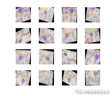 基于yolov2深度学习网络的血细胞检测算法matlab仿真 知乎