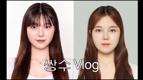 짝눈 탈출 성공~ 자연유착 비절개 쌍수 브이로그 Youtube