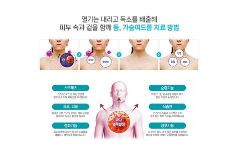 피브로한의원 등 가슴여드름 등 가슴여드름 원인
