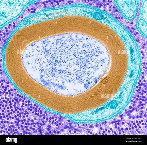 Myelinated Nerve Coloured Transmission Electron Micrograph Tem Of Myelinated Nerve Fibres And