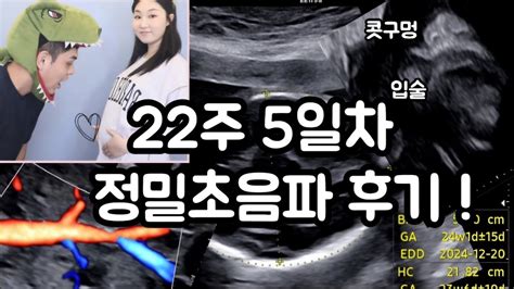 임신vlog 22주5일차 정밀초음파 후기 한달사이 많이컸다 배도 크고나도 크고ㅋㅋㅋ Youtube