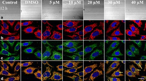 Cytochrome C Release Evaluated By Colocalization Analysis After