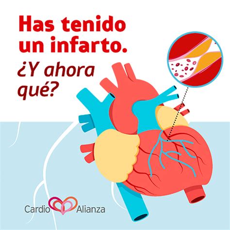Causas De Ataque Cardiaco Las Enfermedades Del Corazón Principal