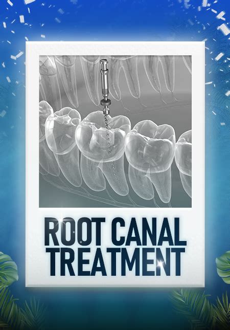 Dental Treatments Land Of Smile