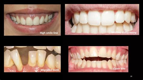 Aesthetic Problem Solving Part 1 Ppt