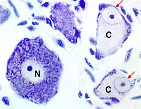Degeneration And Regeneration In The Nervous System Flashcards Quizlet