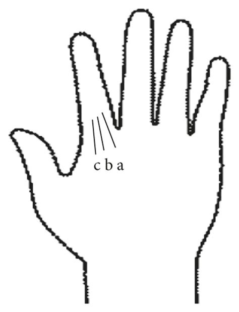 Ultrasonography Of The Metacarpophalangeal Joint Of The Right Index