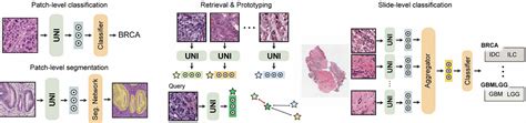 revolutionizing computational pathology with uni s self supervised