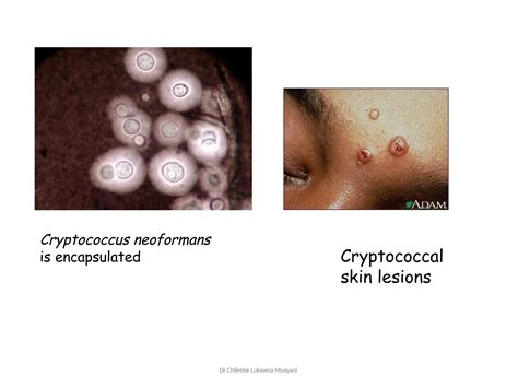 Introduction To Fungi And Mycosespptx Pptx