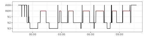 Spindles Detection And Analysis • Rsleep