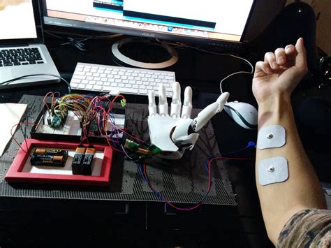 Youbionics Fascinating 3d Printed Bionic Hand Fabbaloo