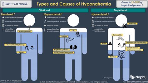 Maintenance Fluids For Hyponatremia At Winnie Norris Blog