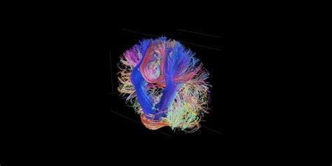 DTI Diffusion Tensor Imaging Neurography Institute