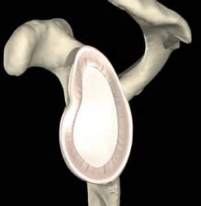 Glenoid Labrum Tear Bodymotion Chiropractic And Sports Injuries Clinic