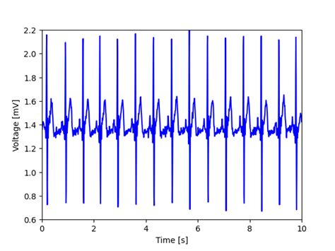 Github Juanbernalrecgdatabase Consolidated Database Of Lead I Ecg