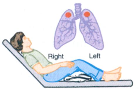 Cpt Comp Flashcards Quizlet