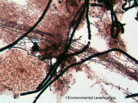 Filamentous Identification