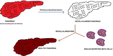 Tissue Engineering Of Pancreas The Idea Is To Generate An Artificial