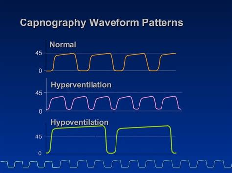 15 Capnography Part2 Introduction
