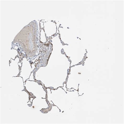 Tissue Expression Of Cgas Staining In Lung The Human Protein Atlas