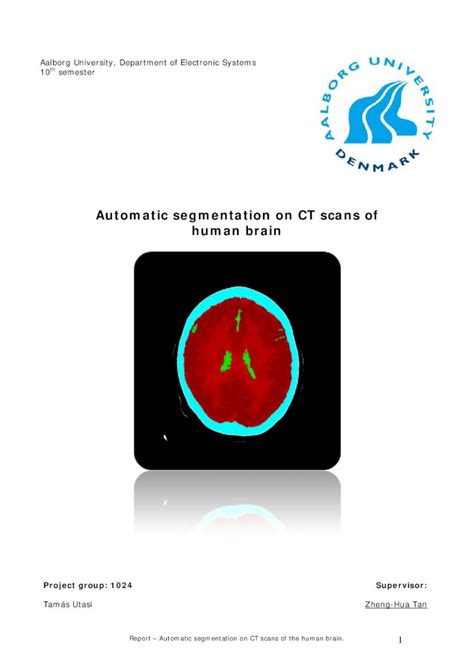 Pdf Automatic Segmentation On Ct Scans Of Human Brainprojekteraaudkprojekterfiles17644151