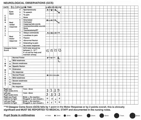 Glasgow Coma Scale Gcs Gcs Assessment Information Sheet Pdf
