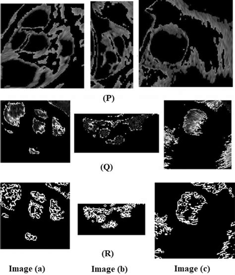 P K Means Clustered Image Q Contrast Enriched Image R Edge