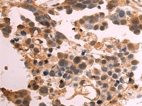 兔抗parp2多克隆抗体anti Parp2 Rabbit Polyclonal Antibody 生命科学产品与技术服务 生工生物工程