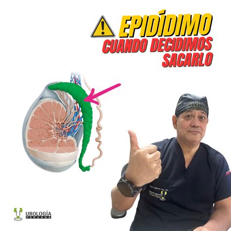 Cuándo Se Decide Extirpar El Epidídimo Urología Peruana Dr Susaníbar
