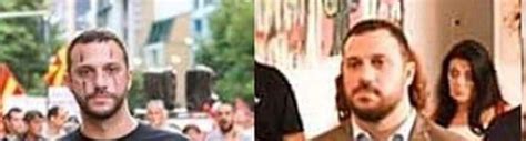 Coke Bloat Before And After