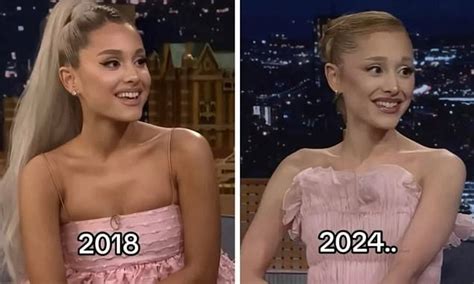 Ariana Grandes New Look Sparks Concern As Doctors Raise Fears Over