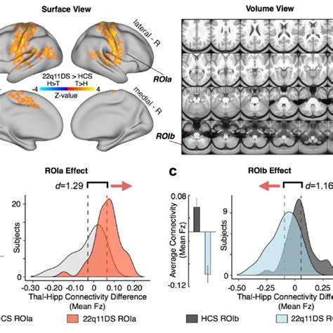Interaction Derived Effects Resting State Functional Connectivity Of Download Scientific