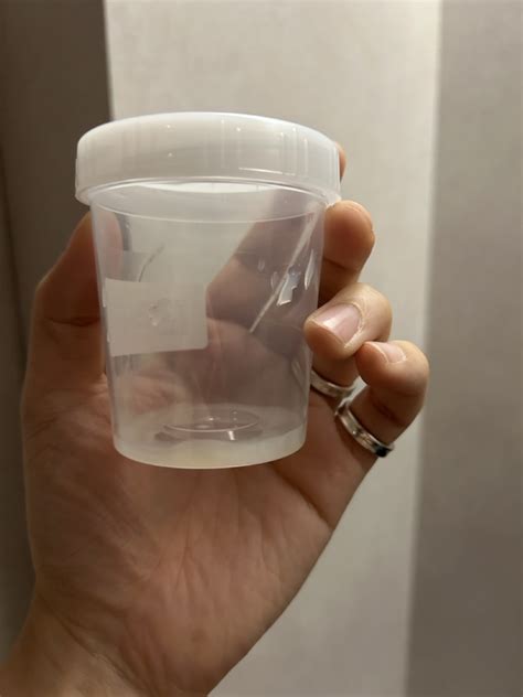 3 4 Ivf 시험관 3차 저자극요법으로 난자채취 Story Book