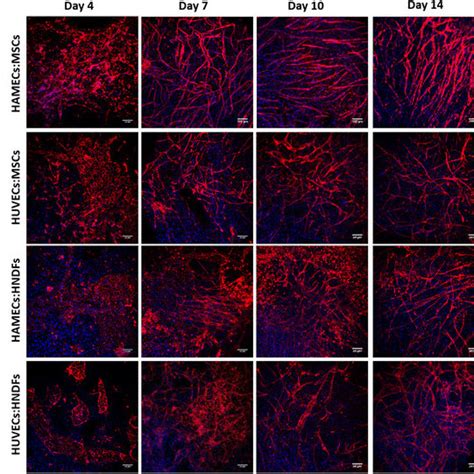 Matlab Analysis Of Vessel Network Complexity Matlab Analysis Of