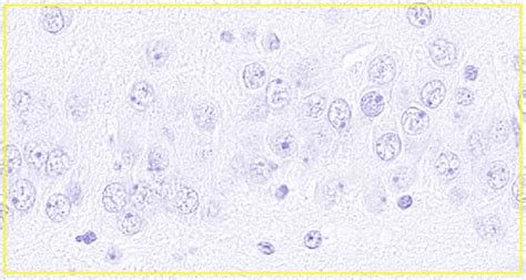 Difficulty With He Cell Detection On Qupath Usage And Issues Image Sc Forum