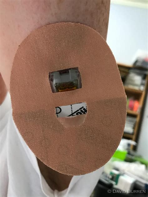 Re Taping My CGM Sensor