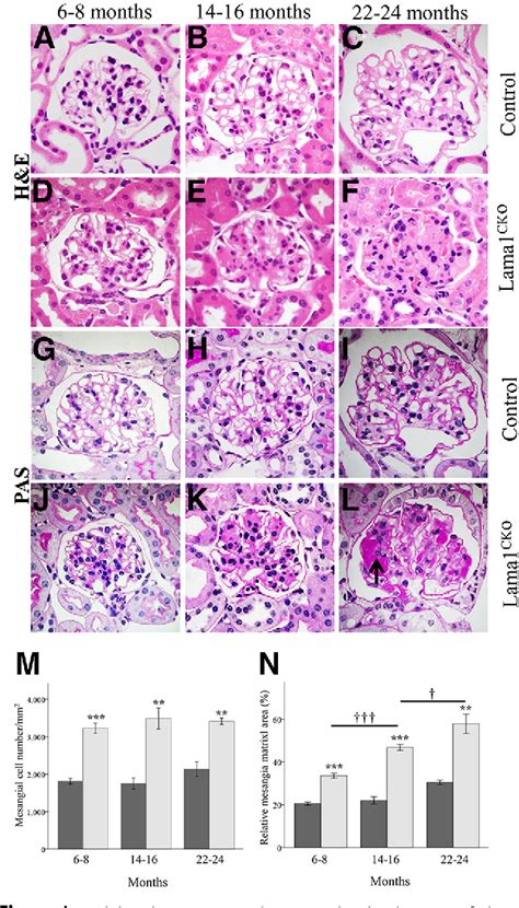 Figure 1 From Laminin A 1 Regulates Age Related Mesangial Cell Proliferation And Mesangial