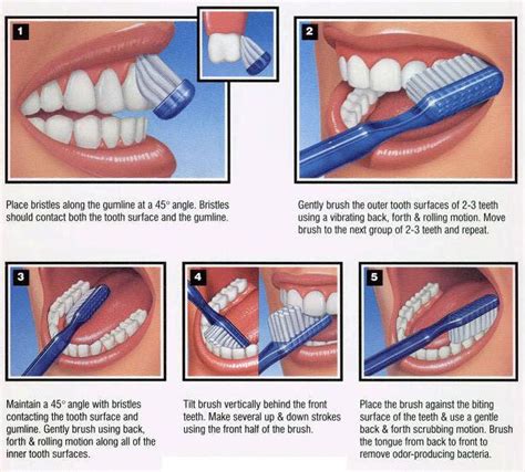 Brushing Technique Bass And Modified Bass Methods Medchrometube