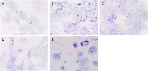 Representative In Situ Hybridisation Stained Formalin Fixed