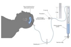 Med Surg Exam Quizlet