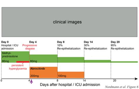 Disease Course Under Jak1 Inhibition Abrocitinib In A Severe Case Download Scientific