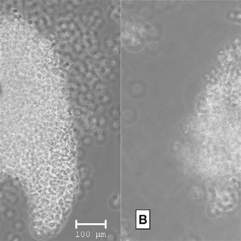 A Oocytes Classified As Healthy Morphological Group G1 B Oocyte Download Scientific